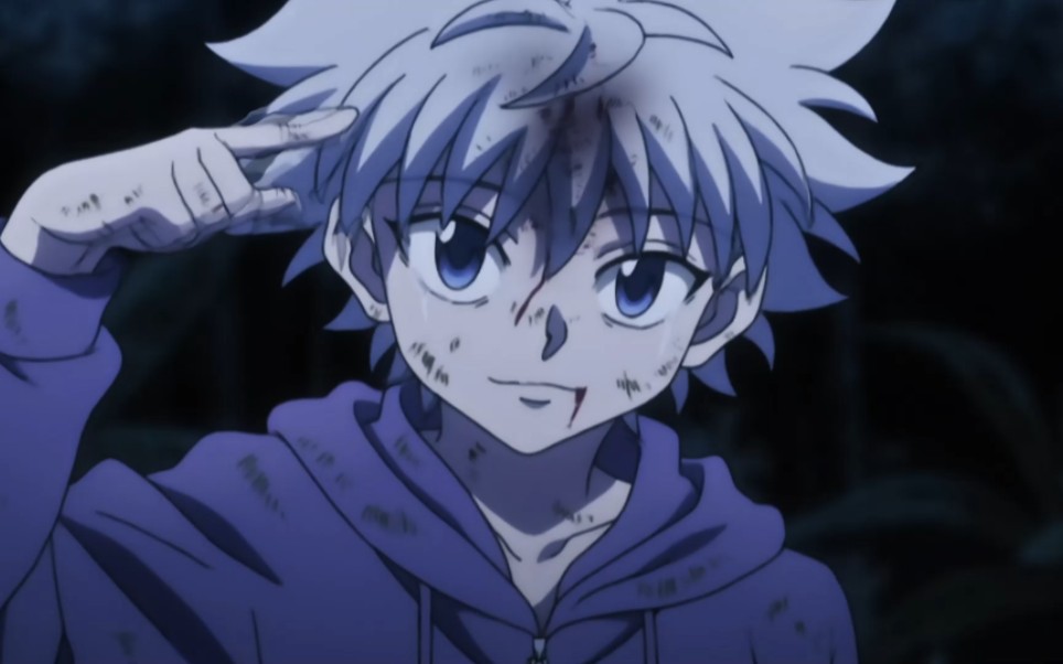 Killua Angry Wallpaper